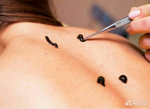 Пиявки медицинские, Восточные имеется сертификата